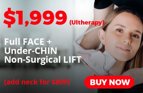ULTHERAPY Full FACE + under-CHIN non-surgical LIFT | #① NYC Botox ...
